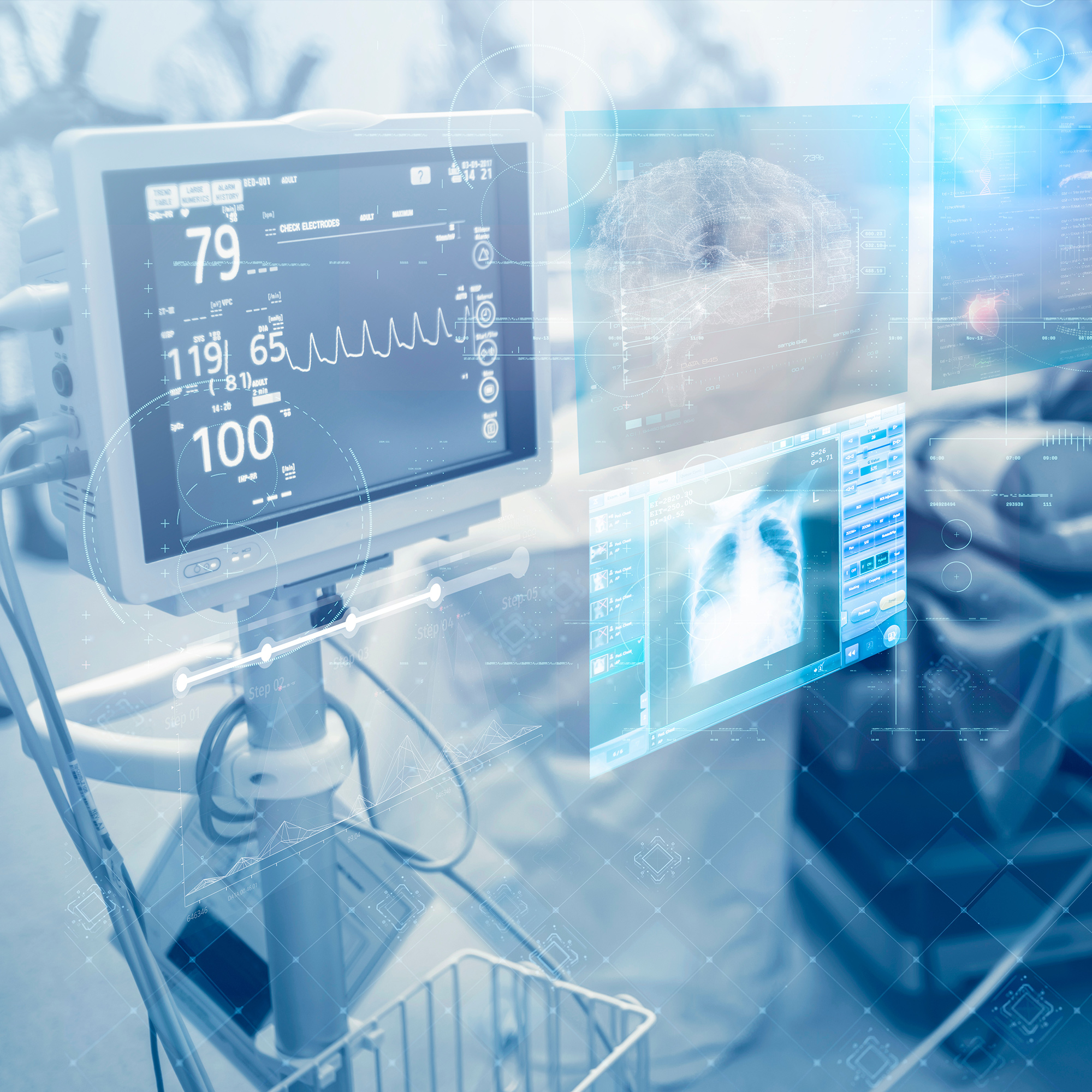 What Is Self Clinch Technology – Clinch Nuts | PEM